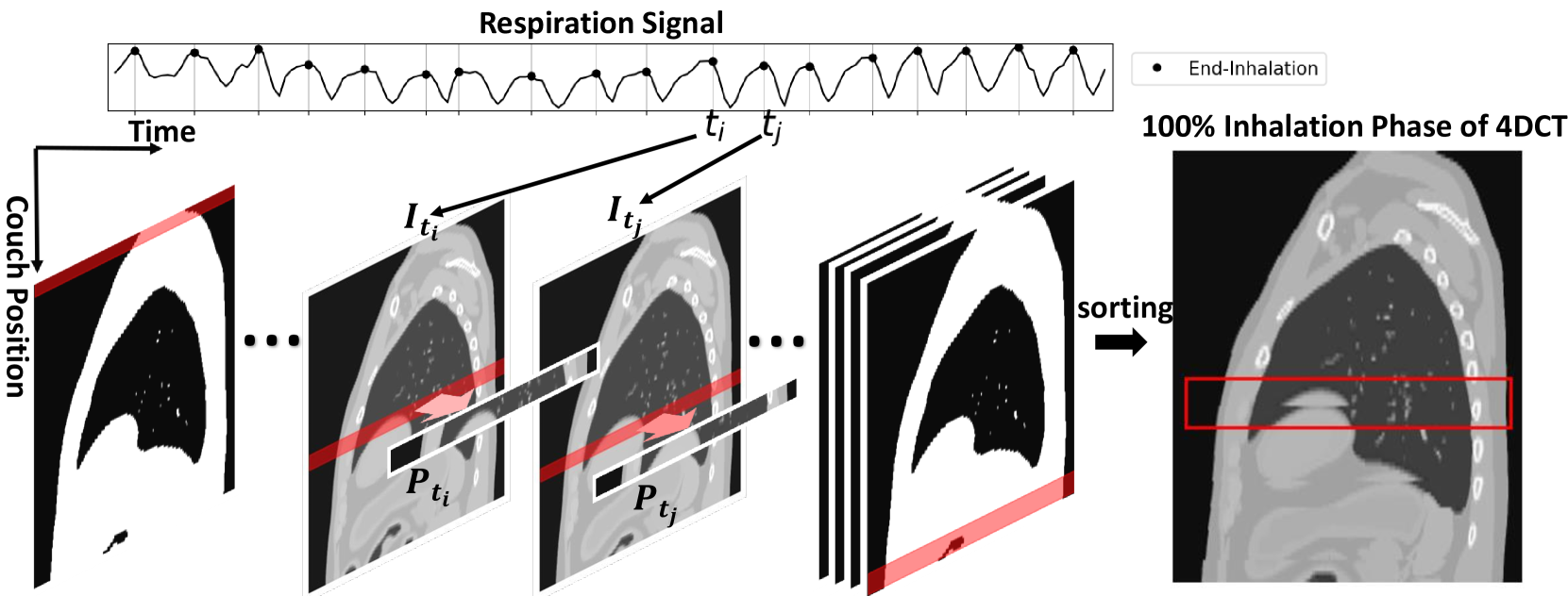 The Useful Side of Motion: Using Head Motion Parameters to Correct for ...
