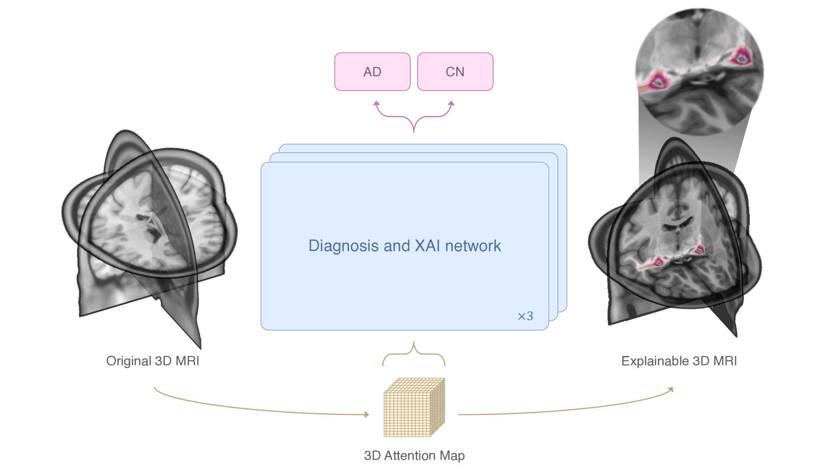 A Quantitative Approach For Evaluating Disease Focus And Interpretability Of Deep Learning