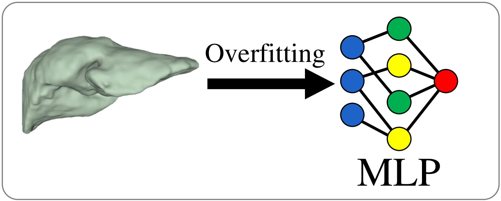Boosting 3d Liver Shape Datasets With Diffusion Models And Implicit Neural Representations Ai 5788