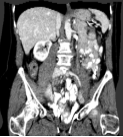 MOSAIC: A Multi-View 2.5D Organ Slice Selector with Cross-Attentional ...