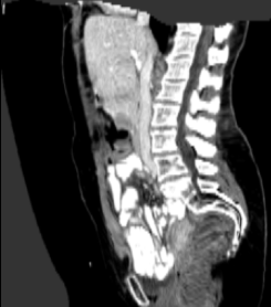 MOSAIC: A Multi-View 2.5D Organ Slice Selector with Cross-Attentional ...