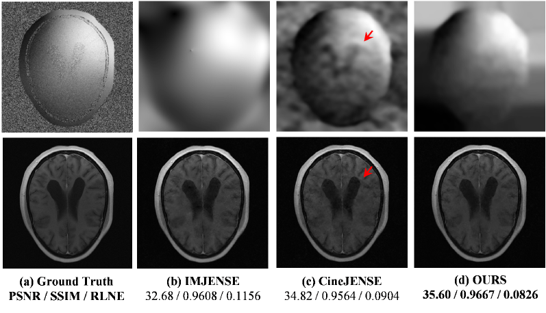 Implicit Neural Representation Based Mri Reconstruction Method With Sensitivity Map Constraints