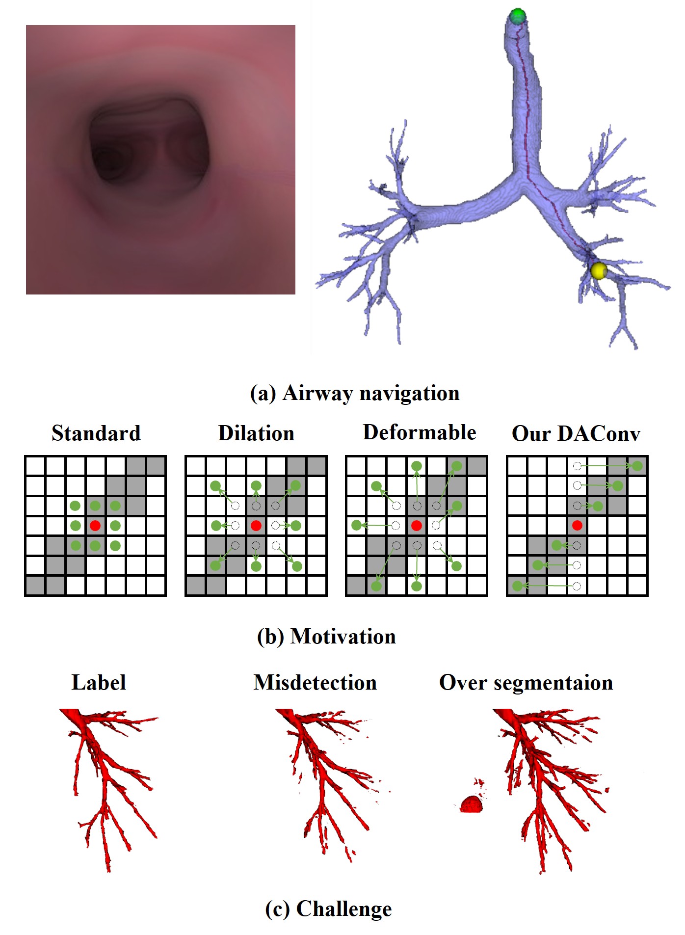 Airway Segmentation Network for Enhanced Tubular Feature Extraction ...
